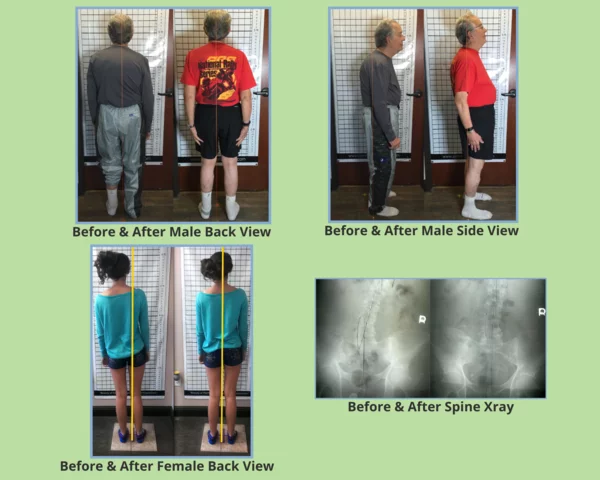 AlignSmart | Manateeyourchoice